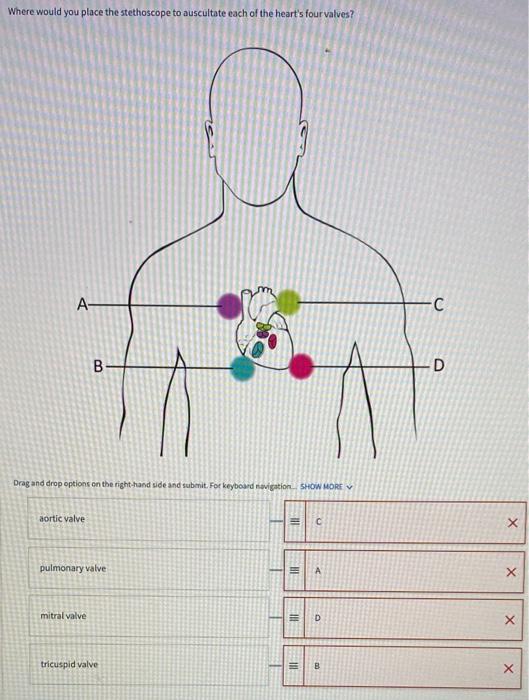 Solved Where would you place the stethoscope to auscultate | Chegg.com
