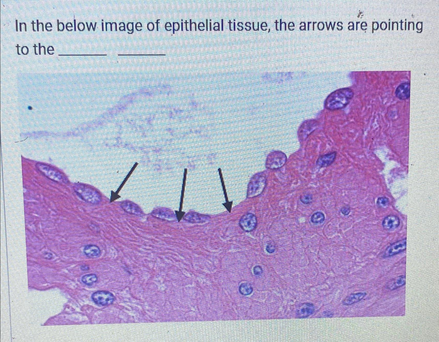 Solved In the below image of epithelial tissue, the arrows | Chegg.com