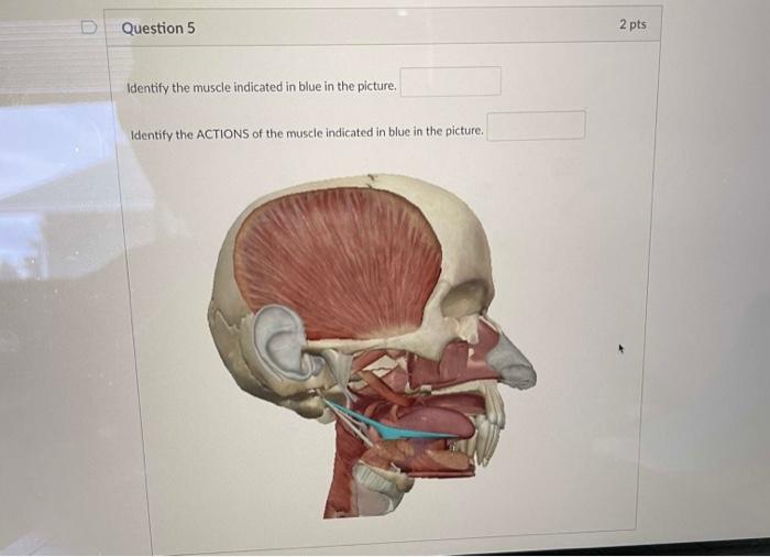 Solved Identify the muscle indicated in blue in the picture. | Chegg.com
