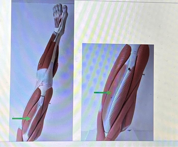 Solved 1. what is the name of the indicated muscle? 2. what | Chegg.com