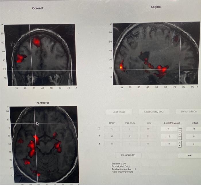 Etatiatica 0.00 Fronta Mat_Ort_L Totw active number 9 | Chegg.com
