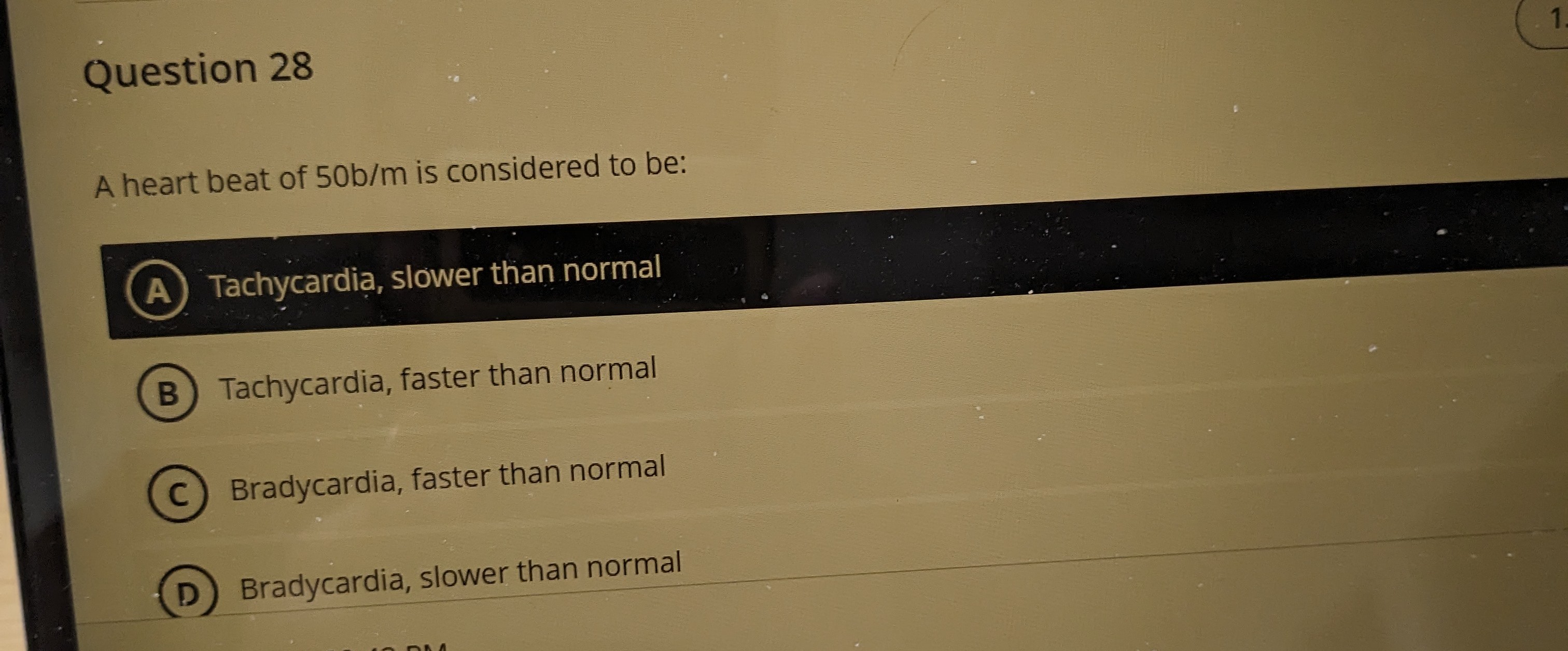 Solved Question 28A heart beat of 50bm ﻿is considered to | Chegg.com