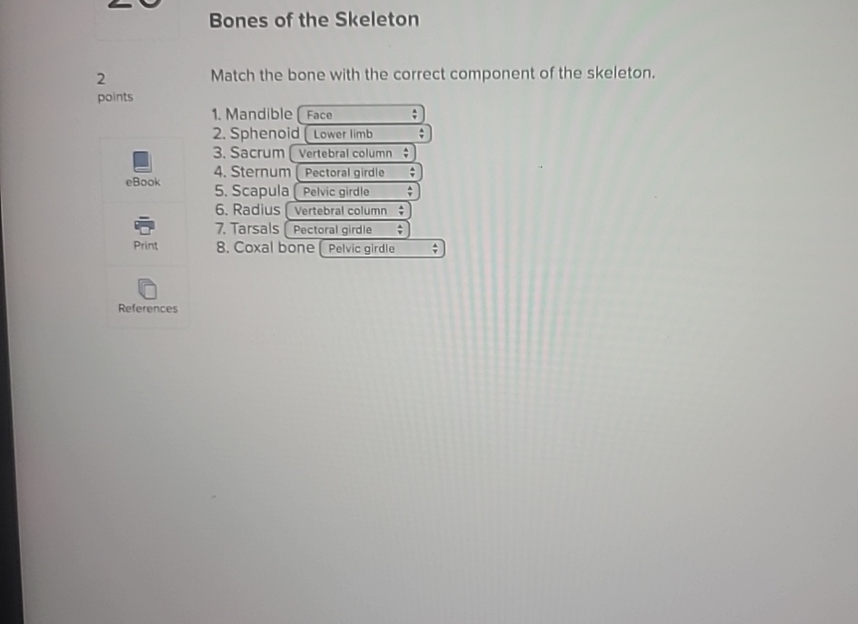 Solved Bones of the Skeleton2 ﻿points | Chegg.com
