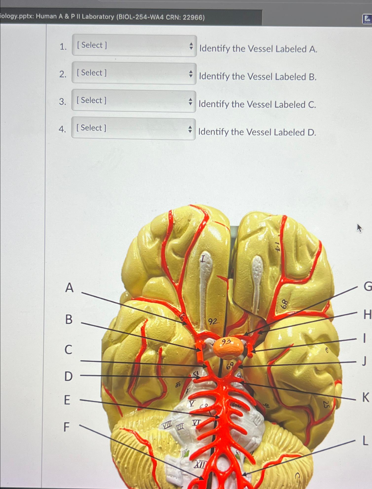 Solved iology.pptx: Human A & P II Laboratory (BIOL-254-WA4 | Chegg.com