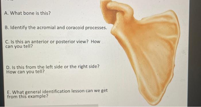 Solved A. What bone is this? B. Identify the acromial and | Chegg.com