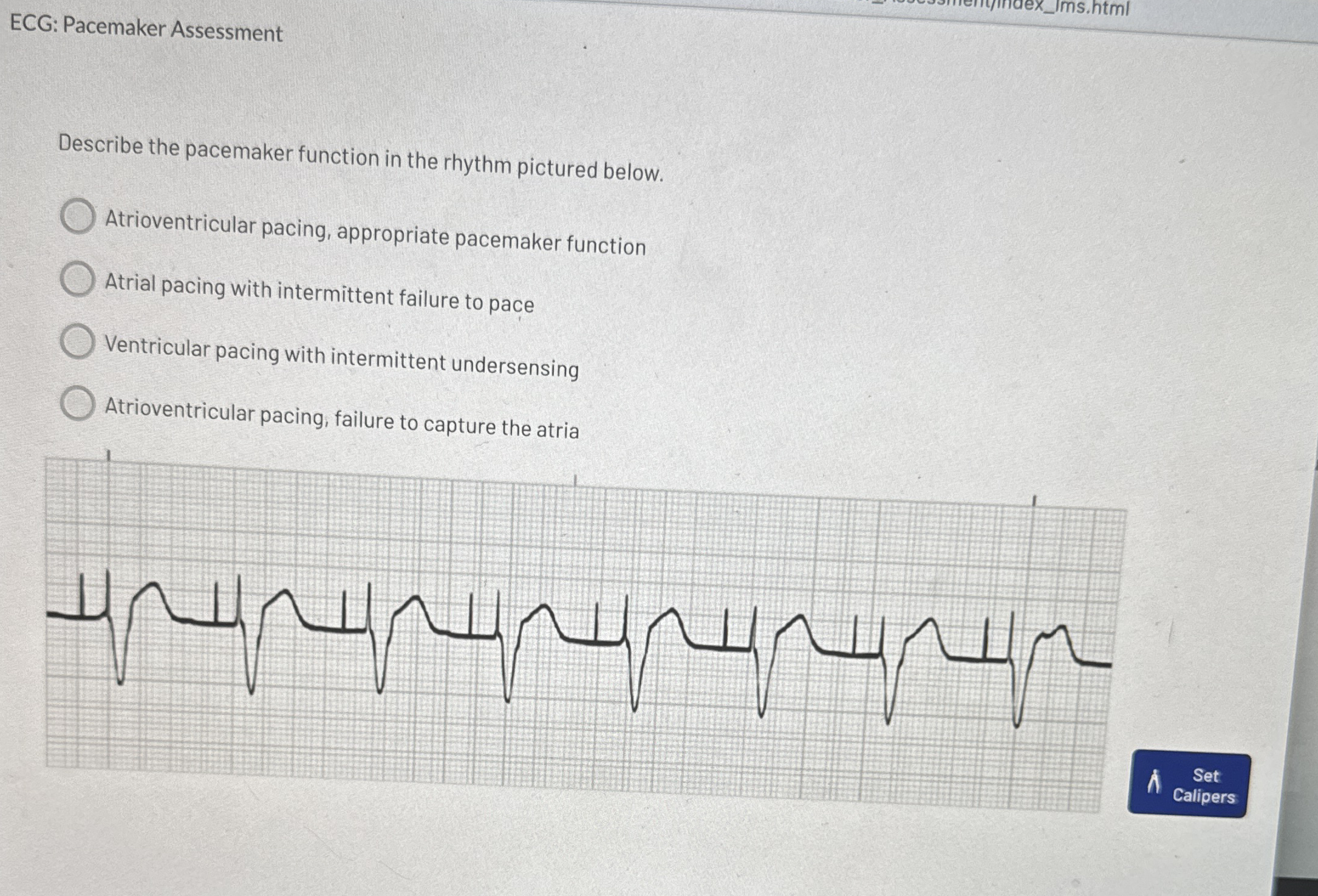 Solved ECG: Pacemaker AssessmentDescribe the pacemaker | Chegg.com