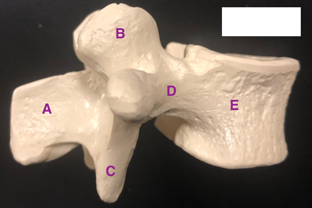 Solved name the bones in the hand, vertabre* ﻿and arm bone. | Chegg.com