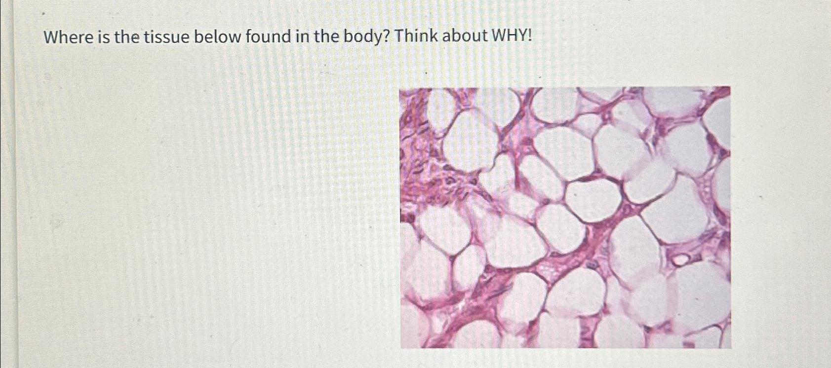 Solved Where is the tissue below found in the body? Think | Chegg.com
