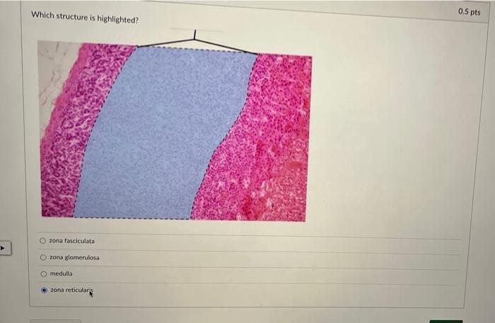 Solved Which structure is highlighted? O zona fasciculata | Chegg.com