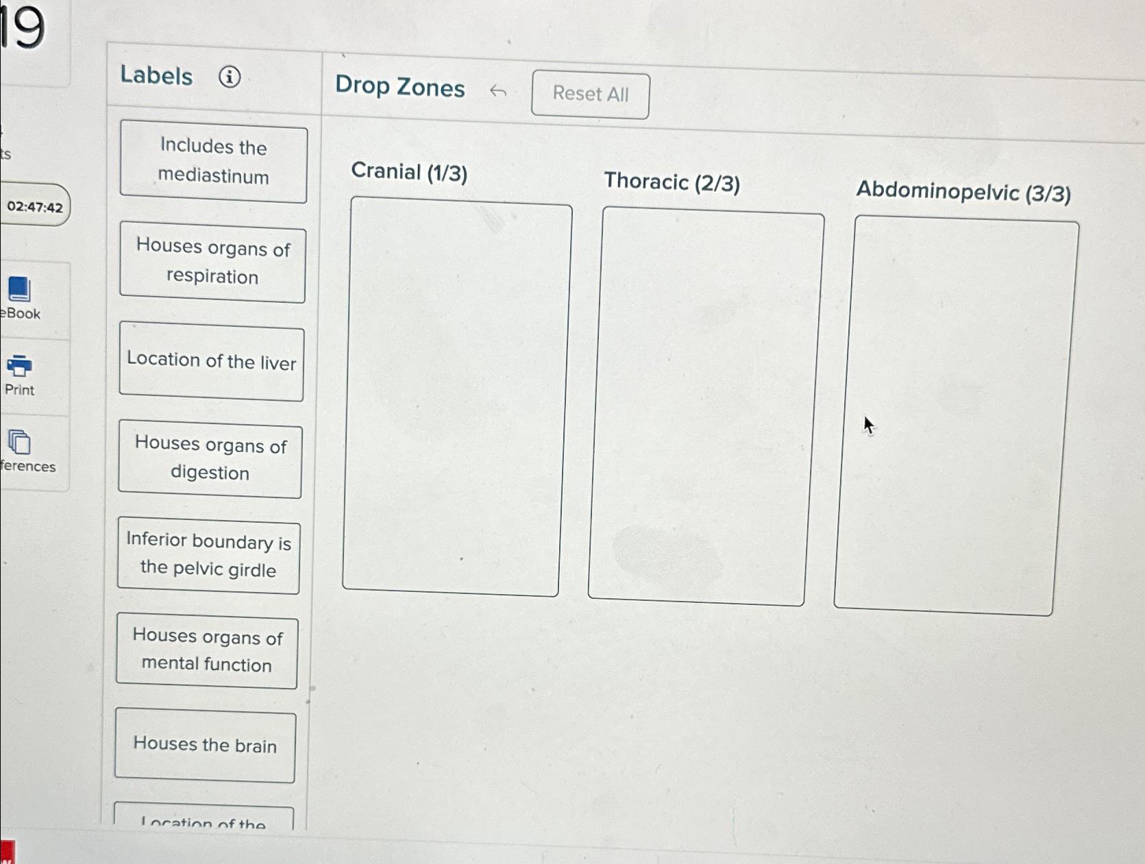 Solved 19\table[[Labels (i).,Drop Zones | Chegg.com