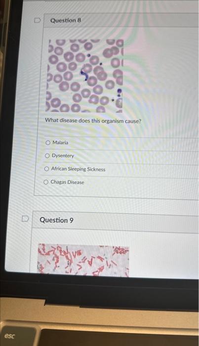 Solved Name the organism (parasite) seen under the | Chegg.com