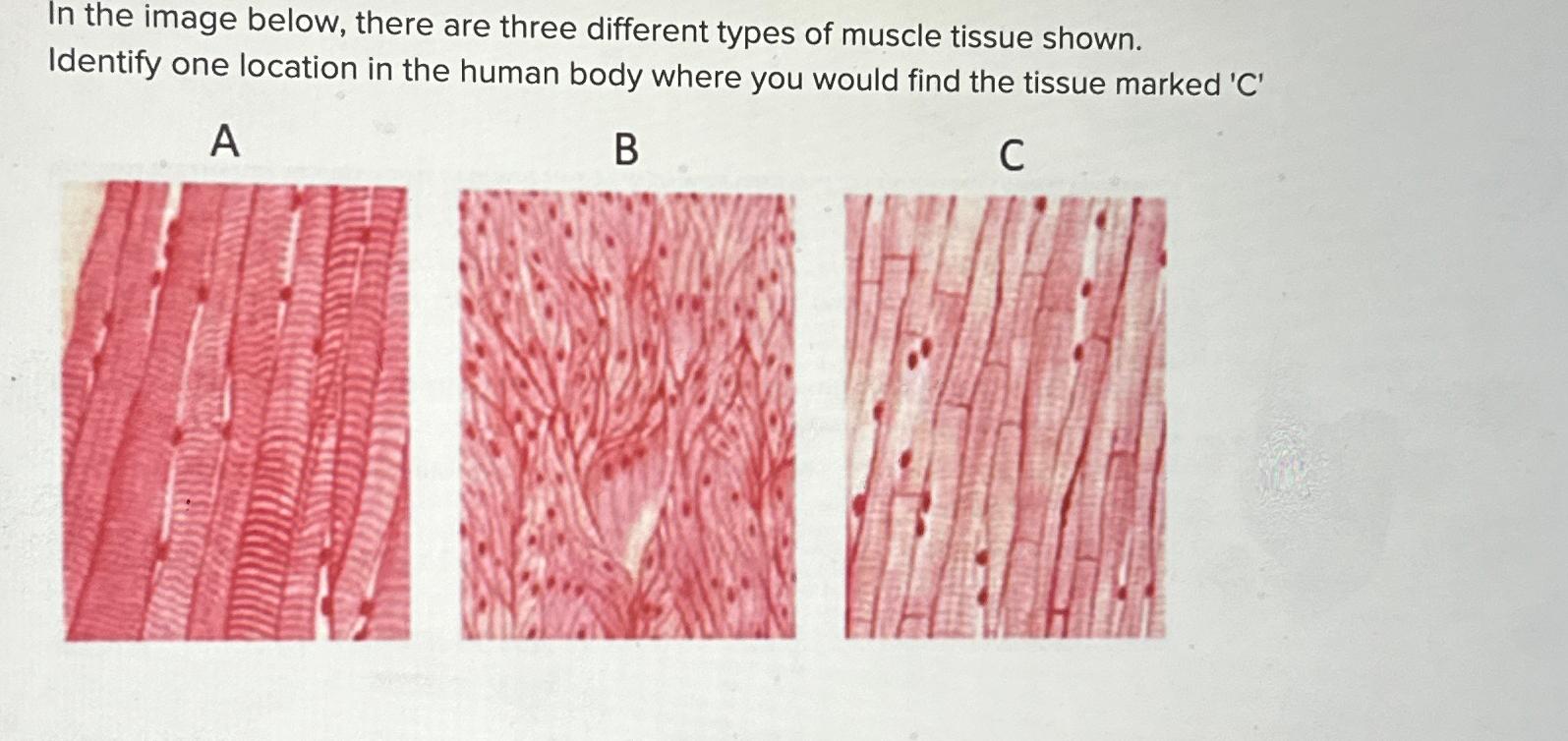 Solved In the image below, there are three different types | Chegg.com
