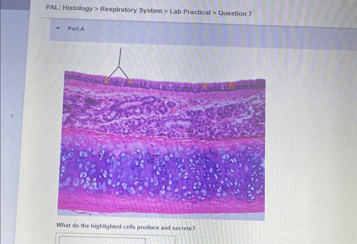 Solved PAL: Histology > Cardiovascular System > Lab | Chegg.com