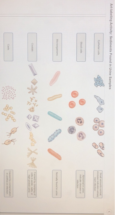Solved Art-labeling Activity: Sediments Found in Urine | Chegg.com