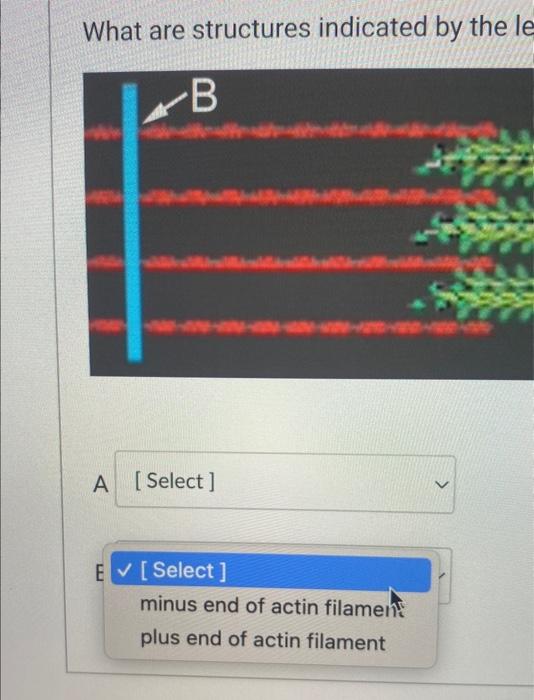 Solved What are structures indicated by the letters A-B? | Chegg.com