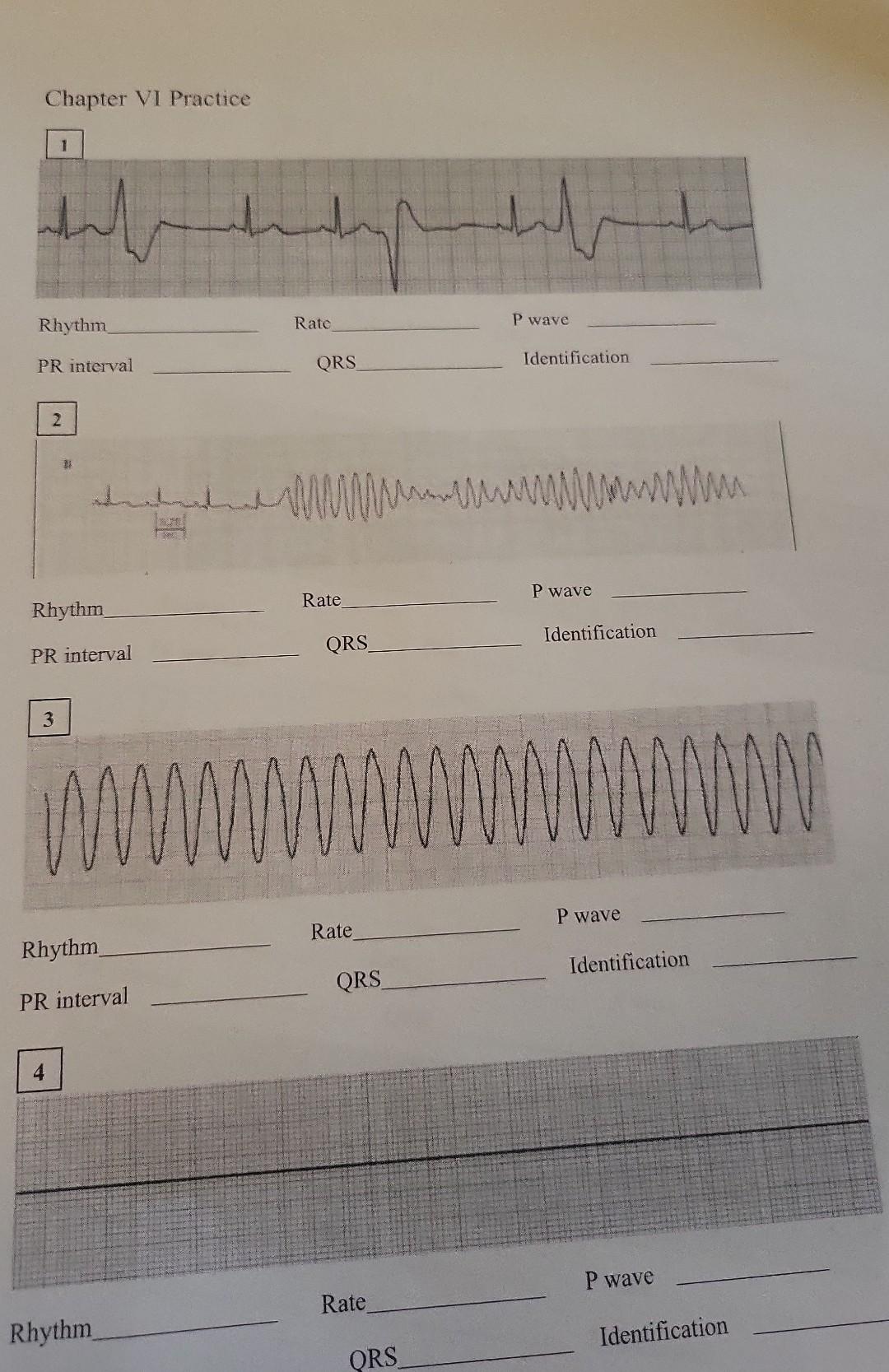 Chapter VI Practice Rhythm Rate P wave PR interval | Chegg.com
