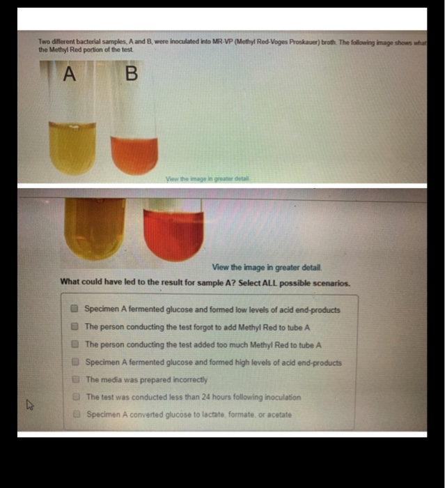 Solved Two different bacterial samples, A and B were | Chegg.com