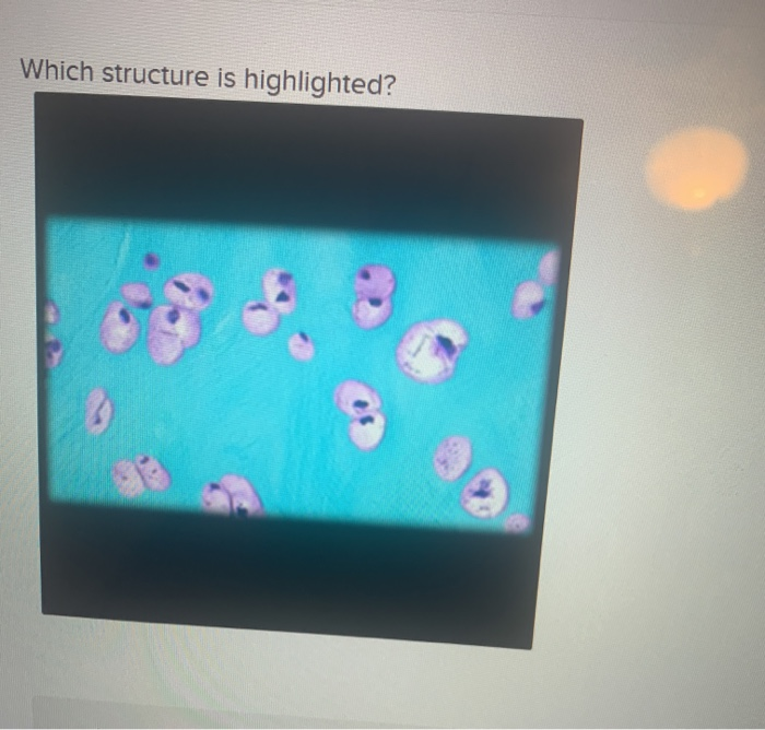 Solved Which structure is highlighted? matrix of hyaline | Chegg.com