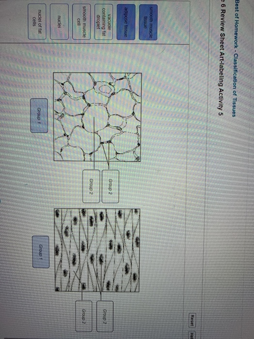 Solved Best of Homework - Classification of Tissues e 6 | Chegg.com Solved Best of Homework - Classification of Tissues e 6 | Chegg.com