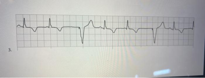 Solved identify the QRS, QT, heart rate and PR, ST, and | Chegg.com