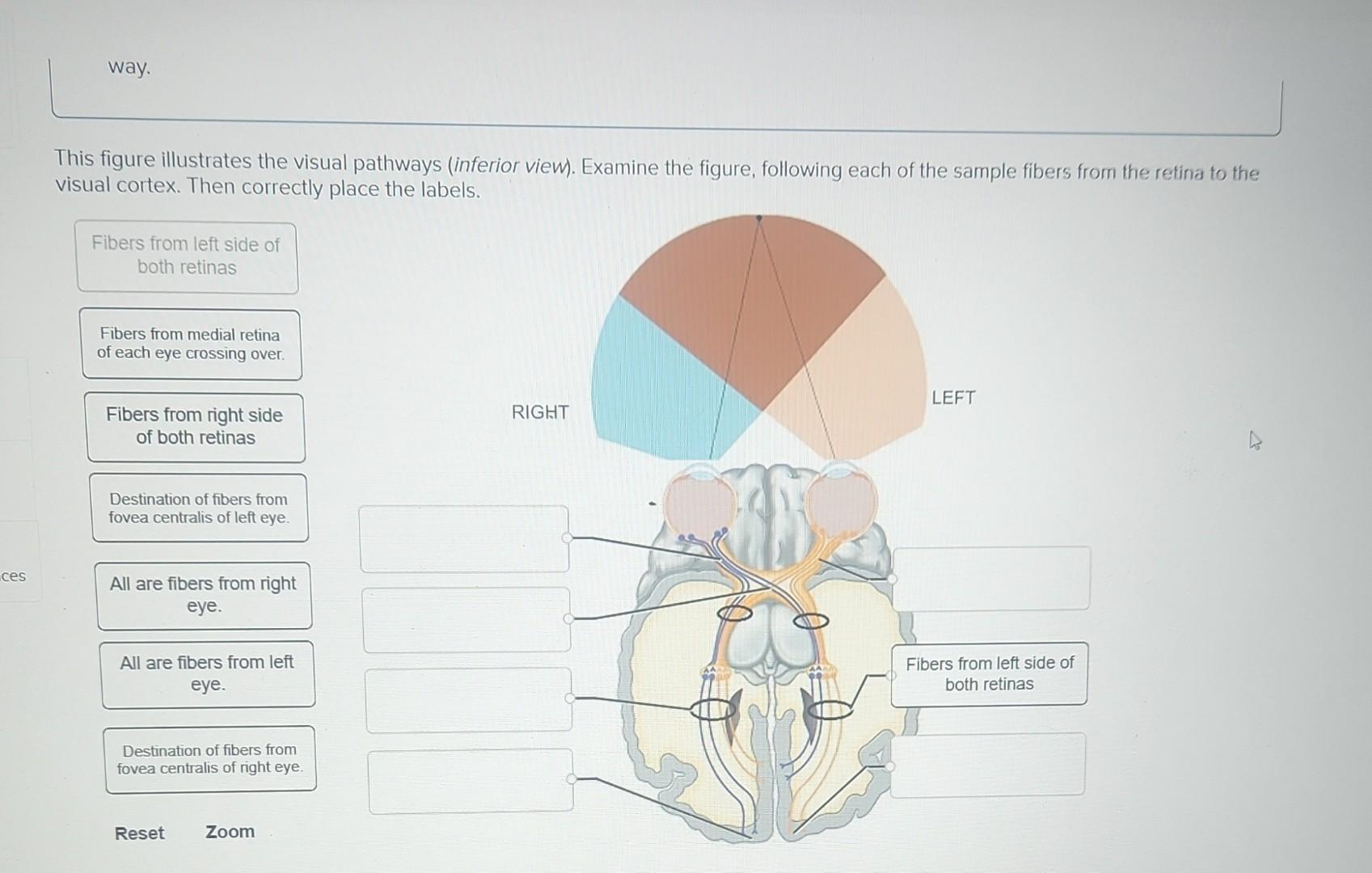Solved Required information Read the overview and complete | Chegg.com