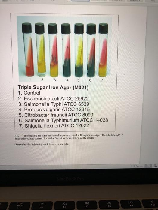 Solved 1 2 3 4 5 6 7 Triple Sugar Iron Agar (M021) 1. | Chegg.com