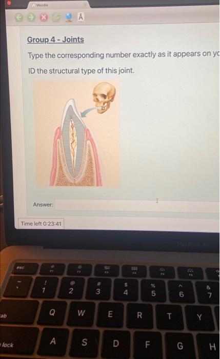 Solved Group 4 - Joints Type the corresponding number | Chegg.com