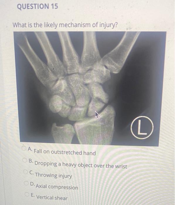 Solved QUESTION 15 What is the likely mechanism of injury? D | Chegg.com