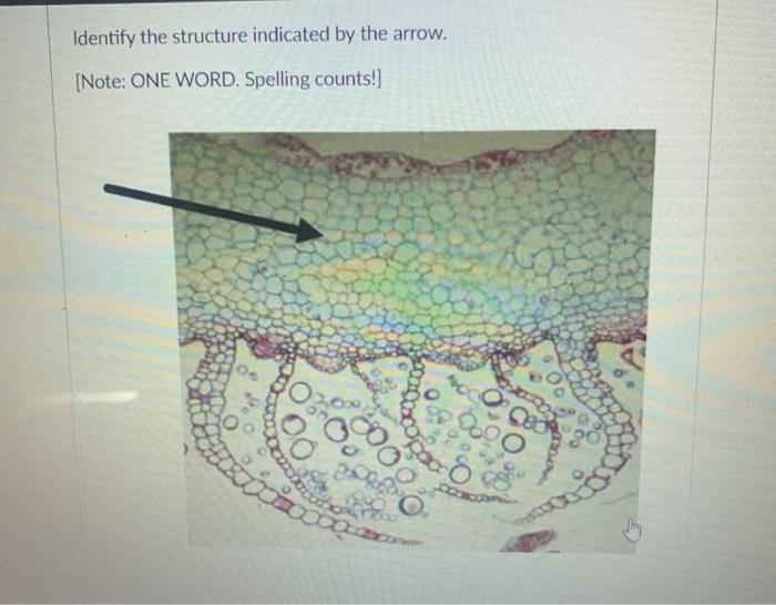 Solved Identify the structure indicated by the arrow. [Note: | Chegg.com