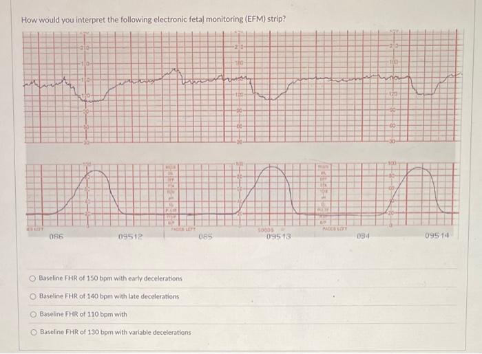 Solved How would you interpret the following electronic | Chegg.com