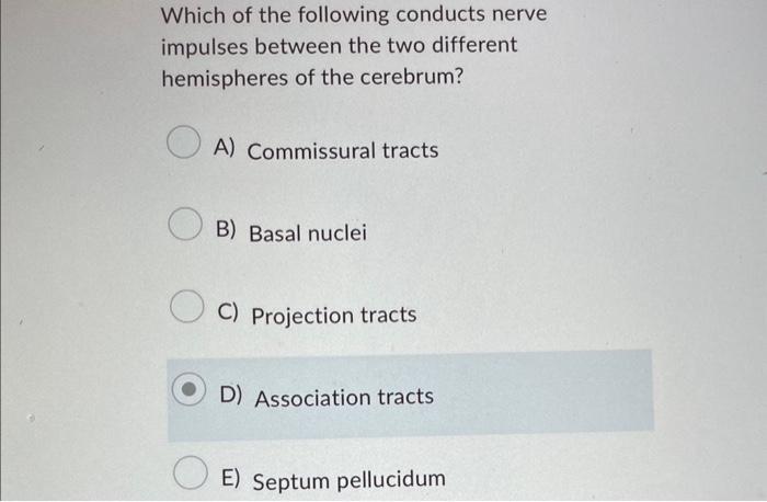 Solved Which of the following conducts nerve impulses | Chegg.com
