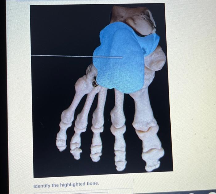 Solved Identify the highlighted bone. | Chegg.com