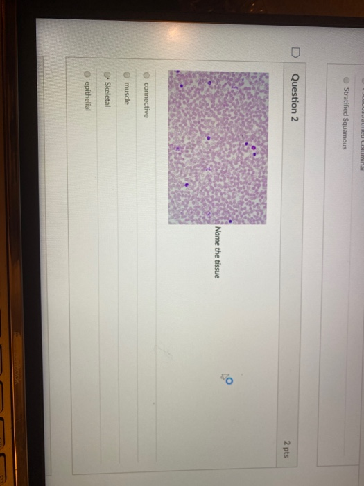 Solved Question 1 Simple Squamous Simple Cuboidal | Chegg.com