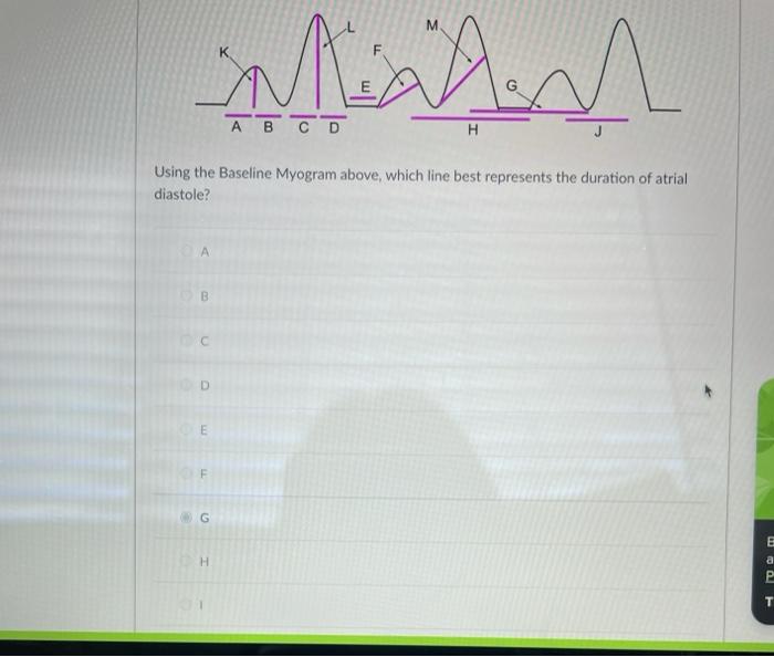 Solved Madd A B C D Using the Baseline Myogram above, which | Chegg.com