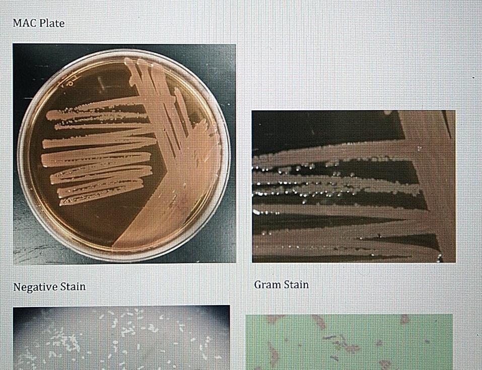 Solved MAC Plate Negative Stain Gram Stain 1 Negative | Chegg.com