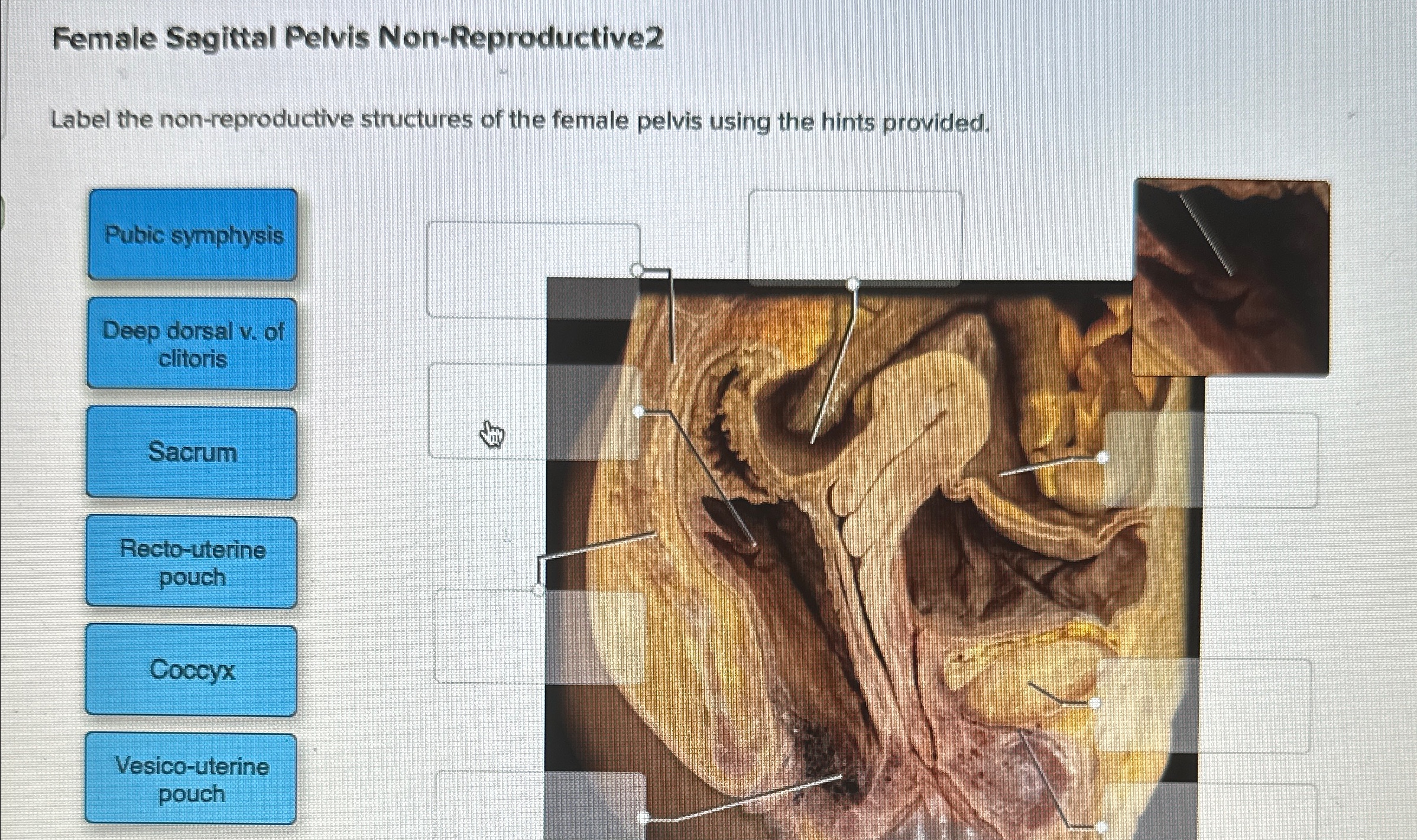 Solved Female Sagittal Pelvis Non-Reproductive2Label the | Chegg.com