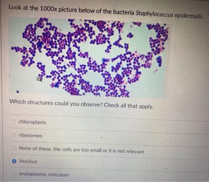 Solved Look at the 1000x picture below of the bacteria | Chegg.com
