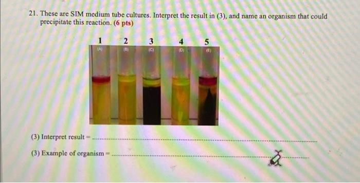 Solved 21. These are SIM medium tube cultures. Interpret the | Chegg.com