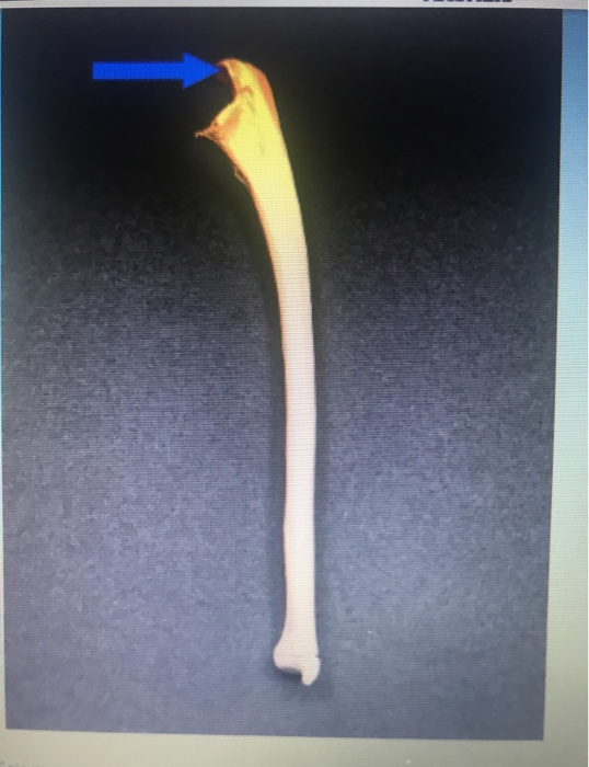 Solved Select one: O a. coronoid process O b. coracoid | Chegg.com