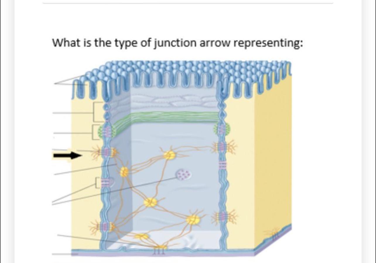 Solved What is the type of junction arrow representing: | Chegg.com