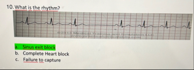 Solved What is the rhythm?a. ﻿Sinus exit blockb. ﻿Complete | Chegg.com
