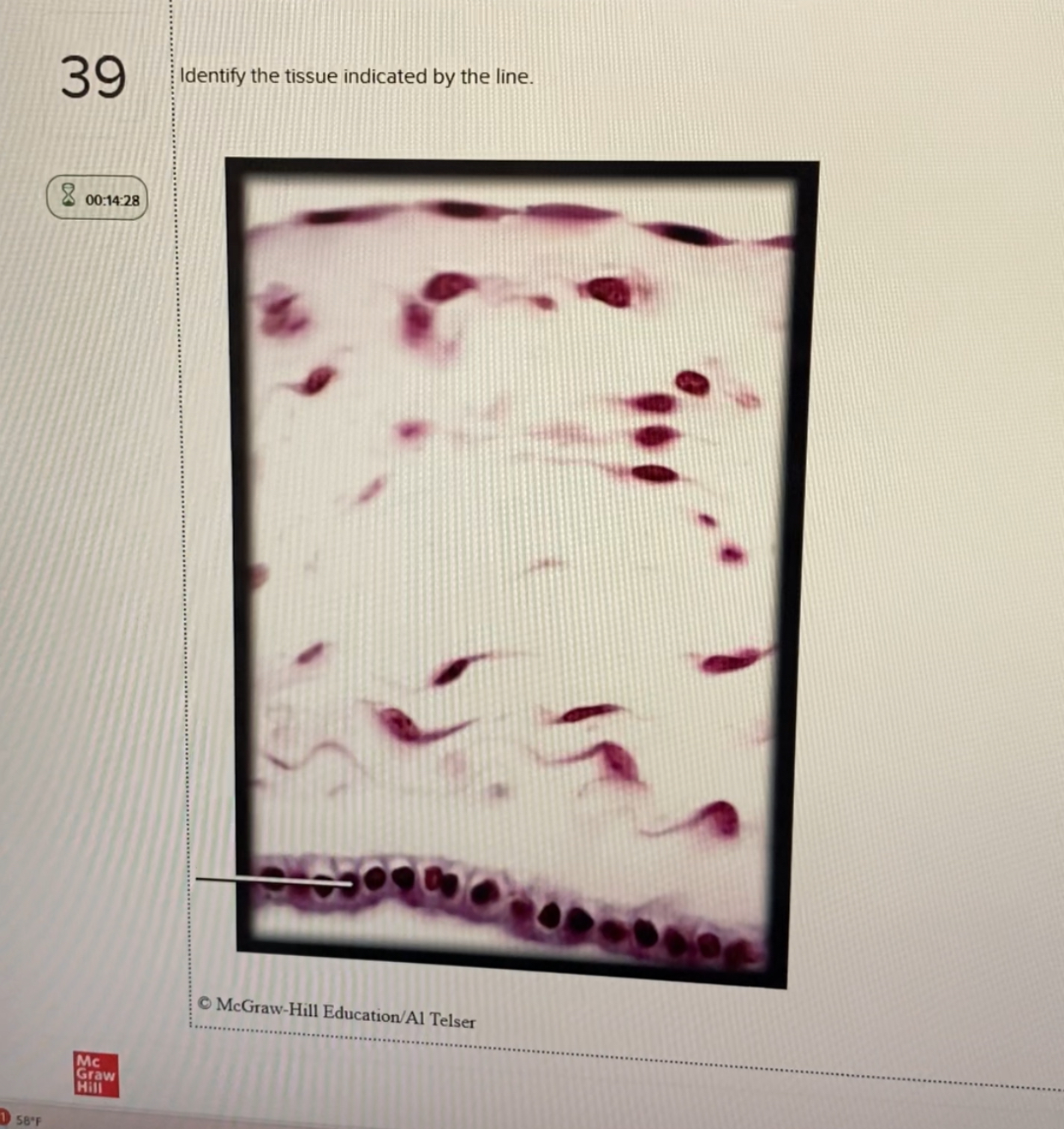 Solved 39Identify the tissue indicated by the line. | Chegg.com