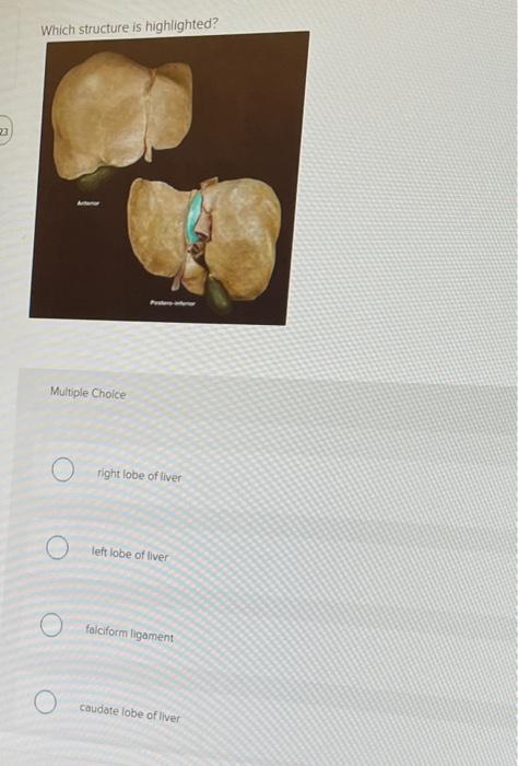 Solved Which structure is highlighted? Multiple Choice right | Chegg.com