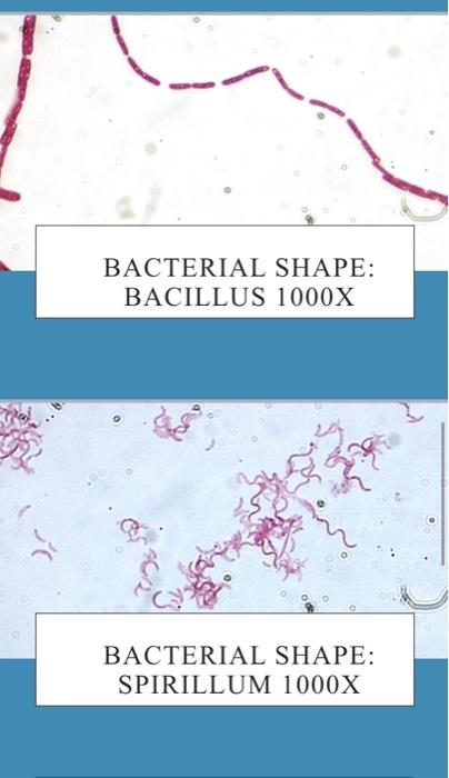 Solved ELODEA LEAF 400X ONION EPIDERMIS 100X HUMAN | Chegg.com