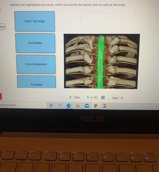 Solved Identify the highlighted structure, which surrounds | Chegg.com