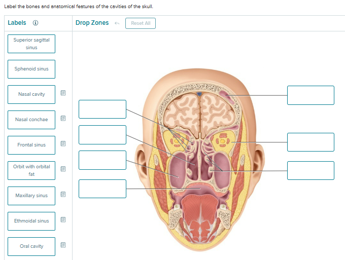 Solved Label the bones and anatomical features of the | Chegg.com