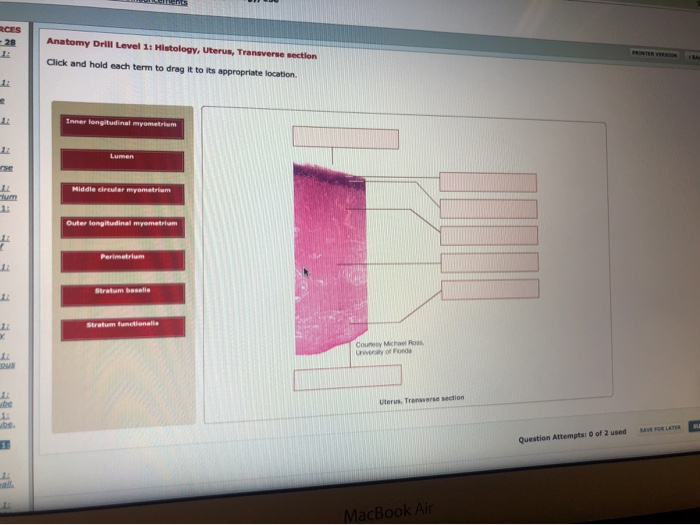 Solved U Help System Announcements Anatomy Drill Level 11 | Chegg.com Solved U Help System Announcements Anatomy Drill Level 11 | Chegg.com