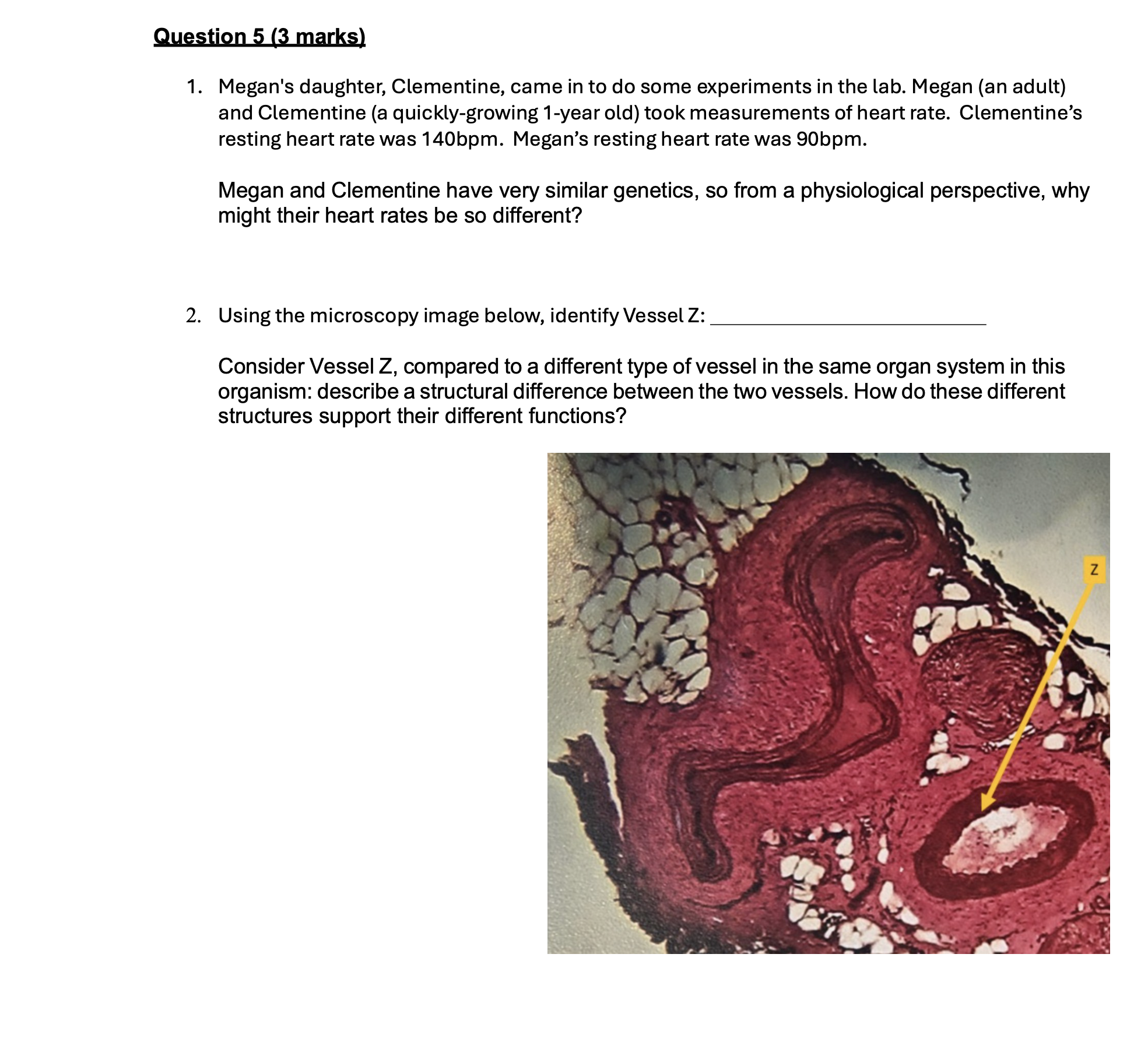 Solved Question 5 (3 marks)Megan's daughter, Clementine, | Chegg.com Solved Question 5 (3 marks)Megan's daughter, Clementine, | Chegg.com