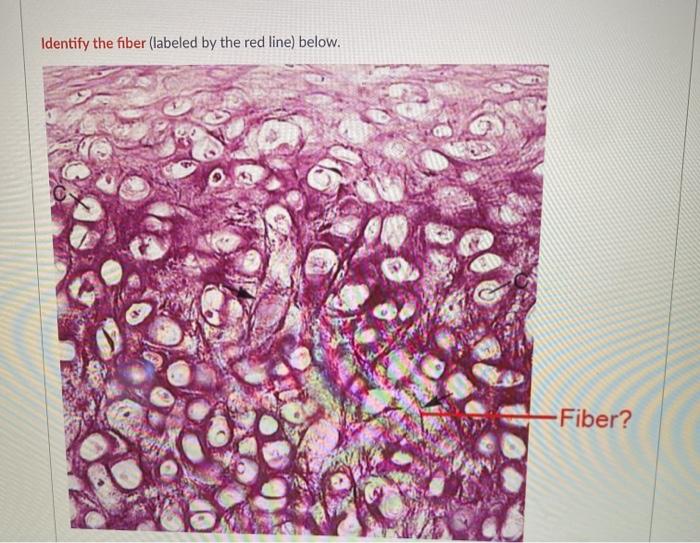 Solved Identify the fiber (labeled by the red line) below. | Chegg.com