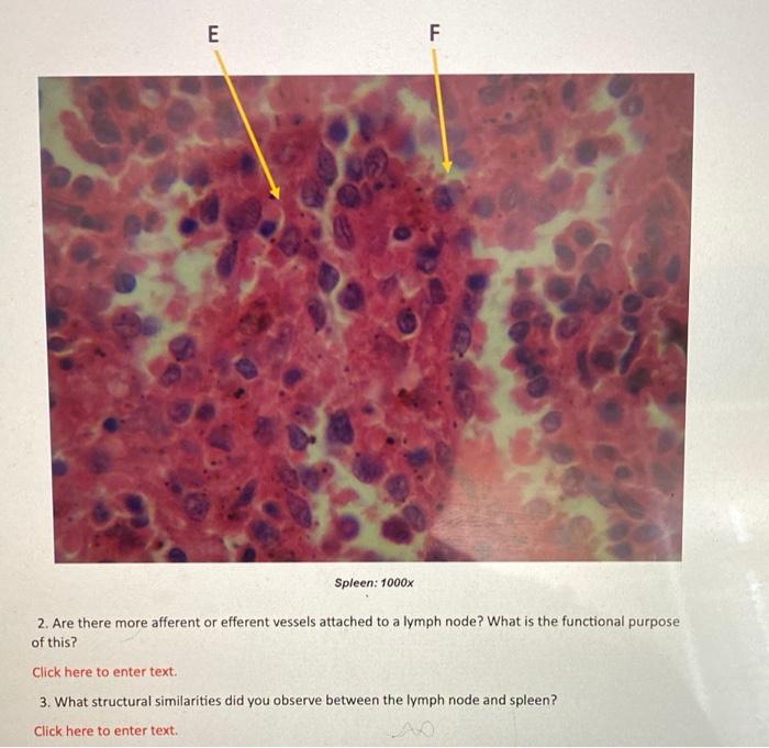 Solved Lymph node: 100X A с D B E חד F Spleen: 1000x 2. | Chegg.com